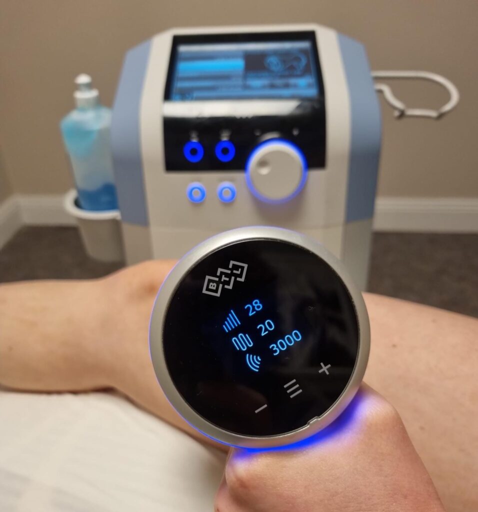Focal Shockwave Therapy | The Physio Lab
